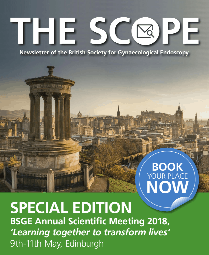 The Scope - BSGE